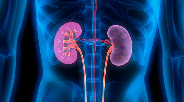 Roche’s Gazyva Secures FDA Approval for Lupus Nephritis Treatment ...