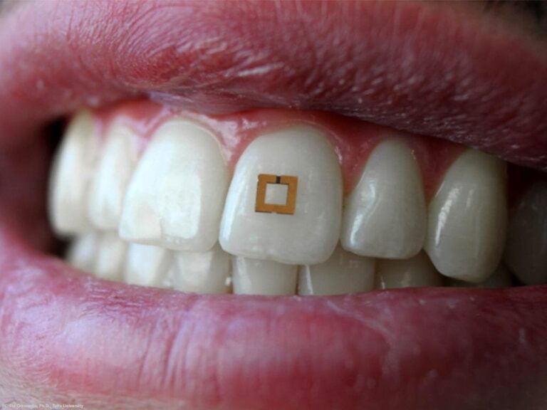 BlancOne Teeth Whitening Revolutionizes Smiles with Speed and Safety ...